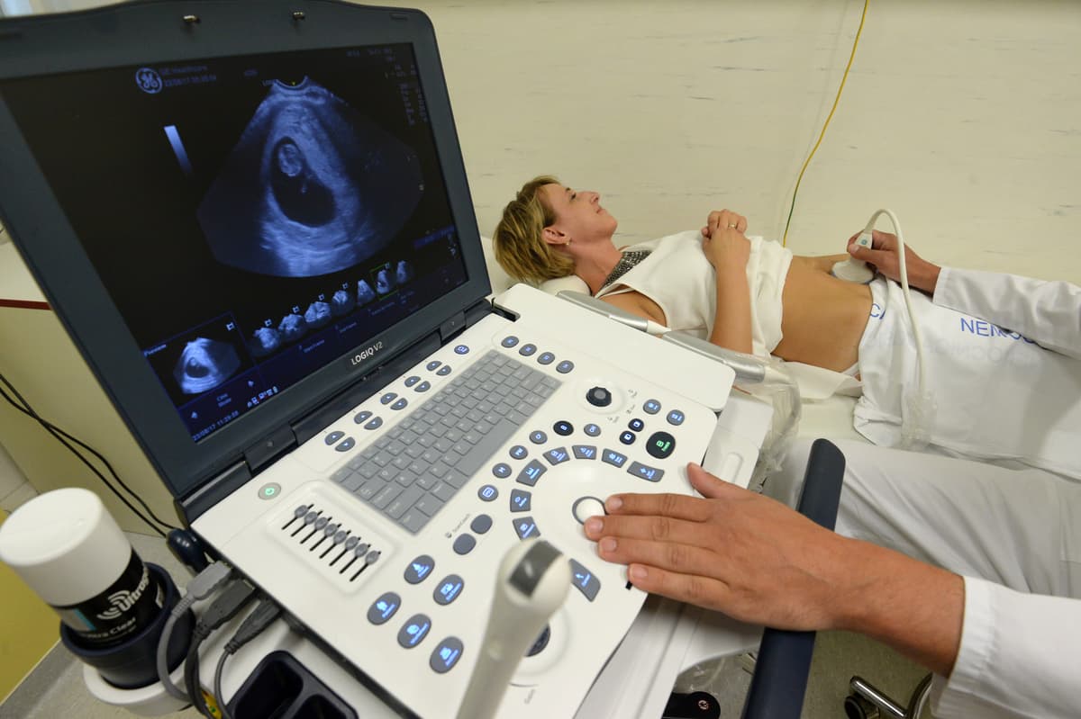 Ženy v Európskej únii odsúvajú prvý pôrod do vyššieho veku | Marker.sk